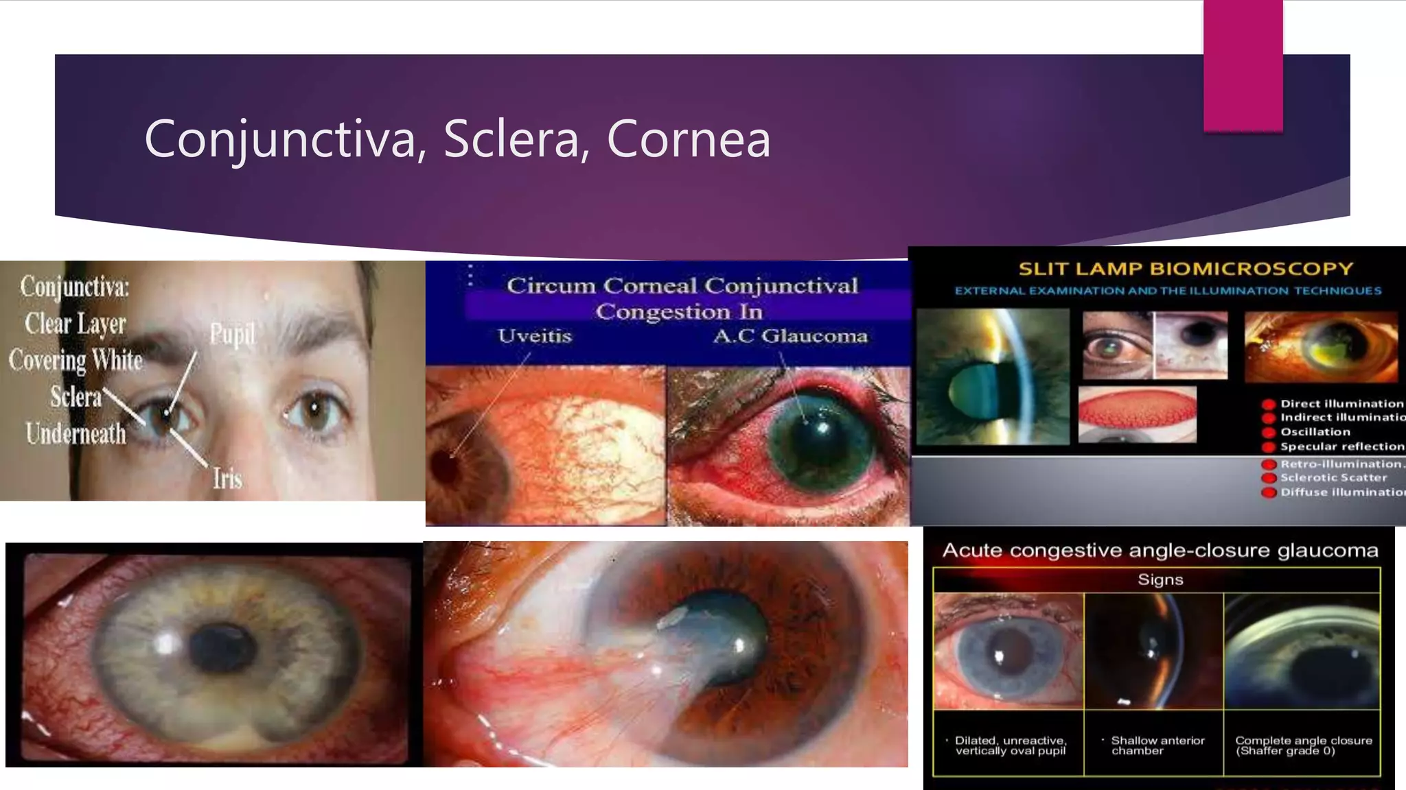 History taking examination and diminution vision | PPTX