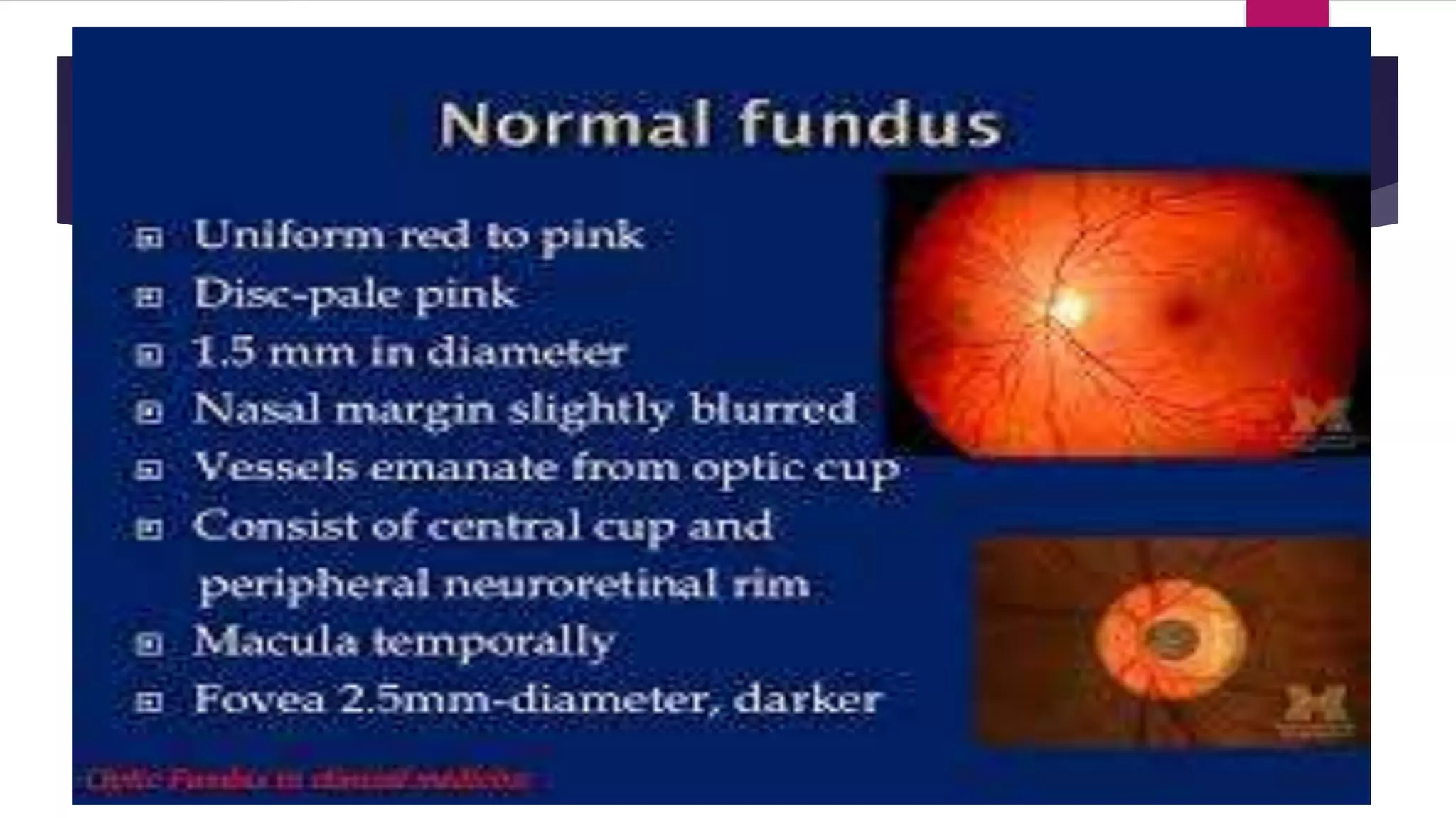 History taking examination and diminution vision | PPTX