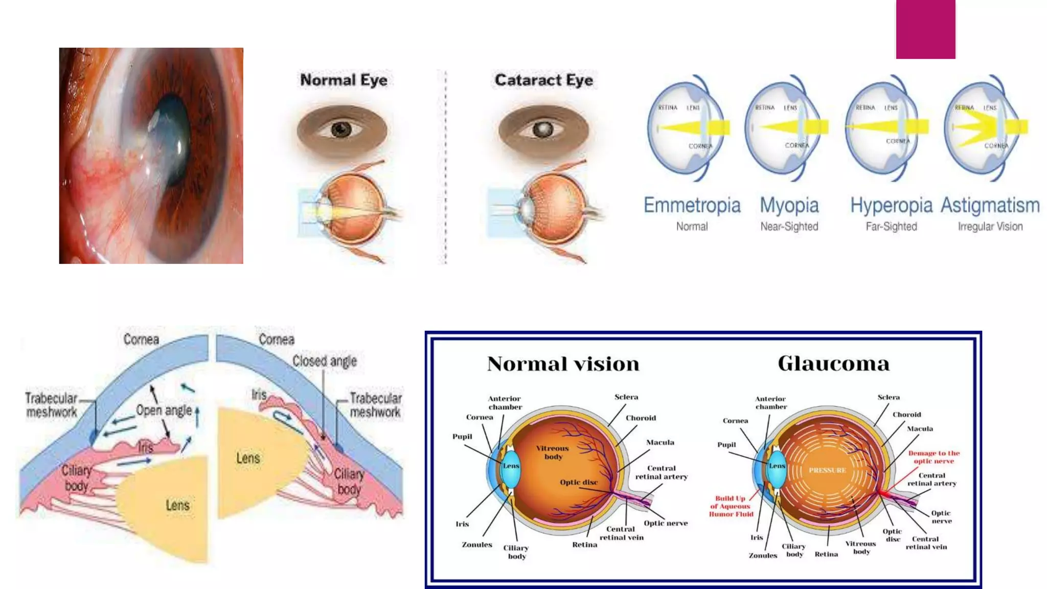 History taking examination and diminution vision | PPTX