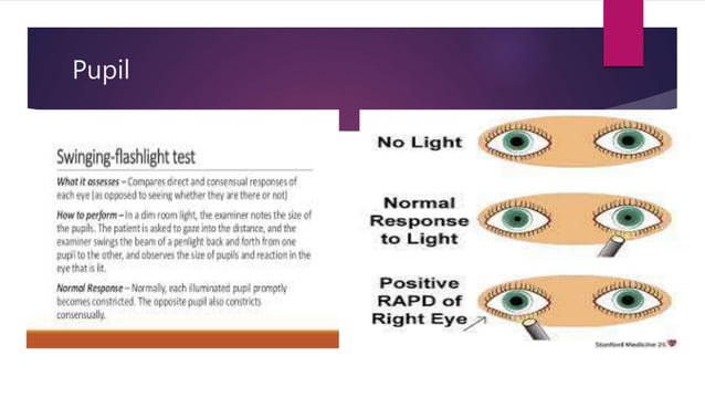 History taking examination and diminution vision | PPTX