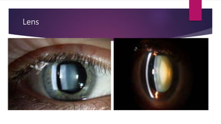 History taking examination and diminution vision | PPTX