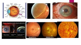History taking examination and diminution vision | PPTX