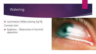 History taking examination and diminution vision | PPTX