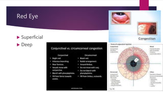 History taking examination and diminution vision | PPTX