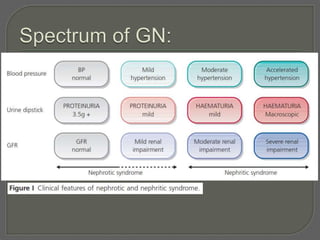 Glomerulonephritis: History taking and examination. | PPTX
