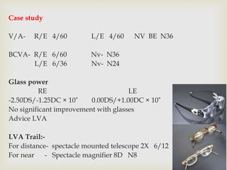 History taking of low vision | PPTX