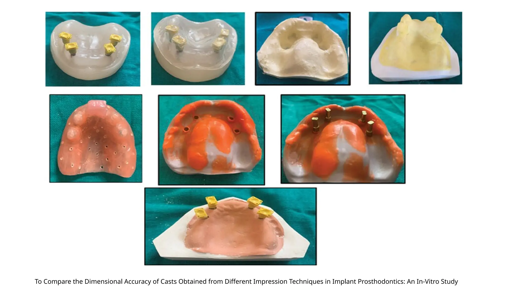 histoy and development of dental implant | PPTX
