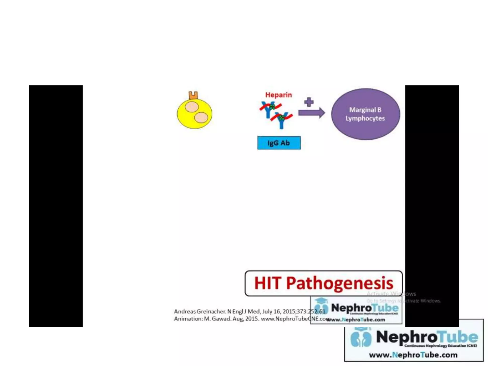 Heparin-Induced Thrombocytopenia (HIT) - Renal Perspective - Dr. Gawad ...