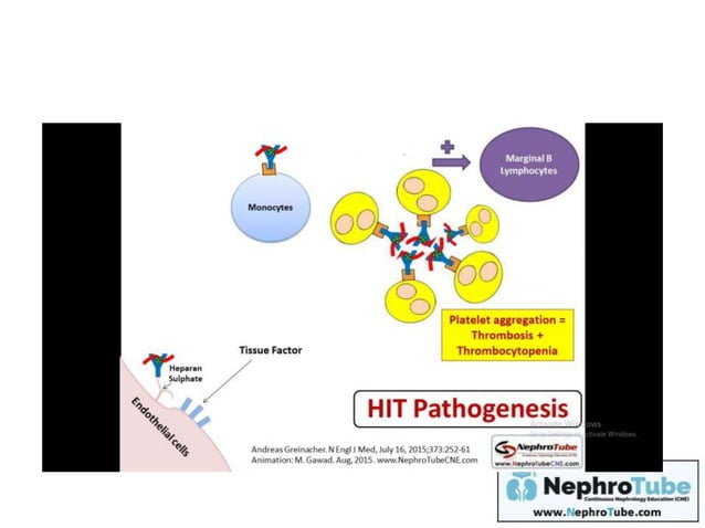 Heparin-Induced Thrombocytopenia (HIT) - Renal Perspective - Dr. Gawad ...