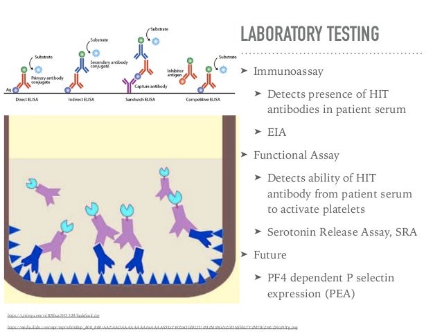 Heparin Induced Thrombocytopenia