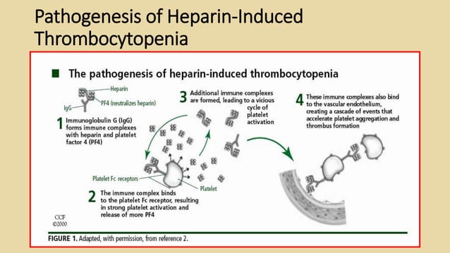 Heparin Induced Thrombocytopeia (HIT) | PPT