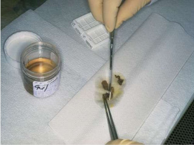 fixatives used in histopathology