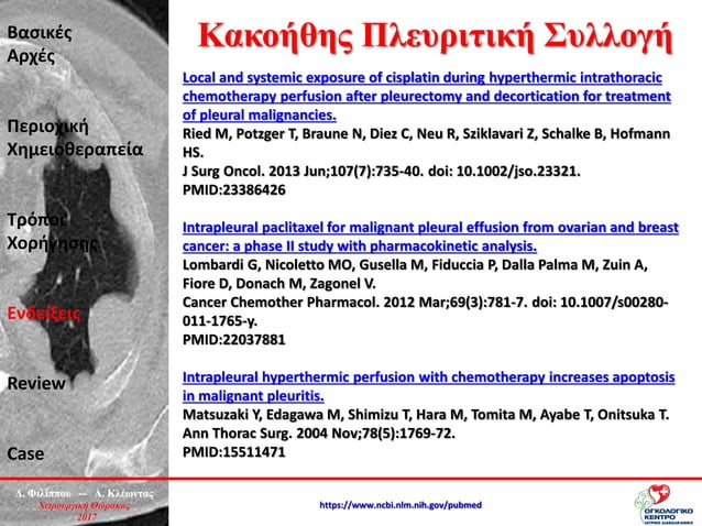 HITHOC - Hyperthermic Intrathoracic Chemotherapy - Ενδοθωρακική ...