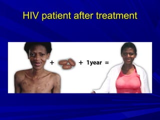 Hiv | PPT