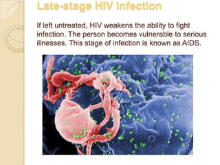 HIV/AIDS | PPTX