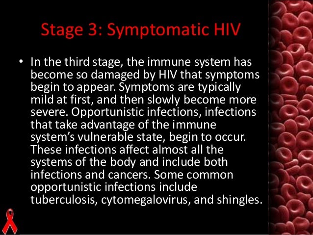 Hiv aids presentation