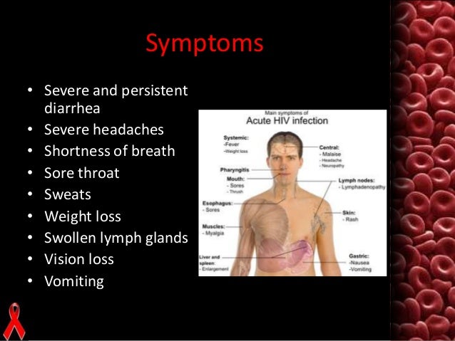 Hiv aids presentation