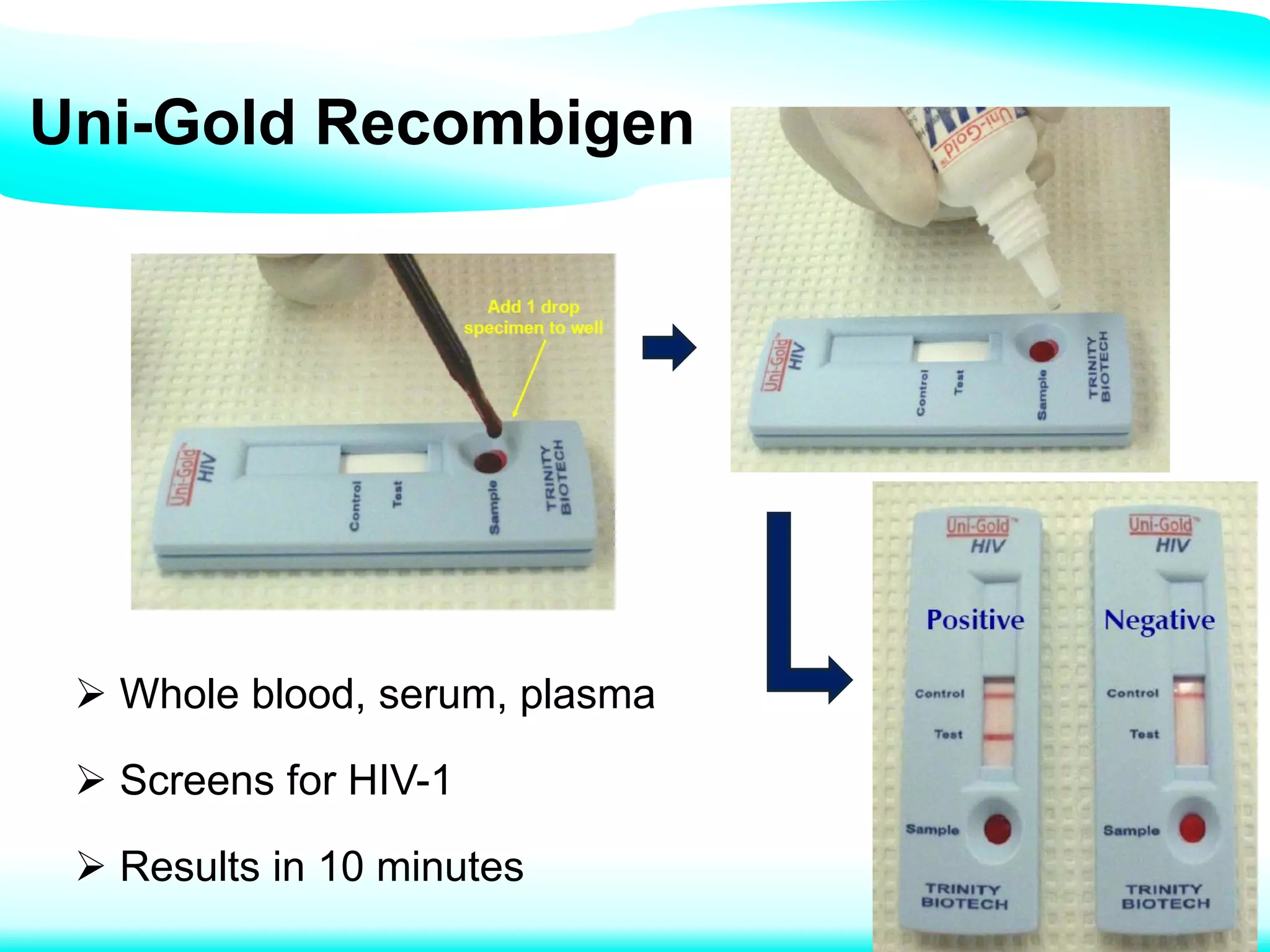 Laboratory diagnosis and monitoring of HIV | PDF
