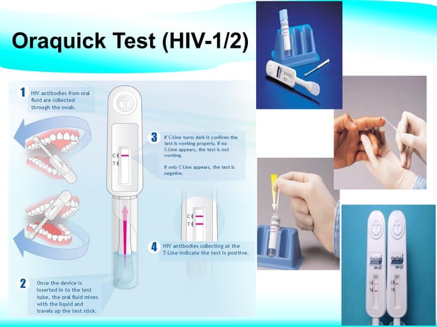 Laboratory diagnosis and monitoring of HIV | PDF | Infectious Diseases ...