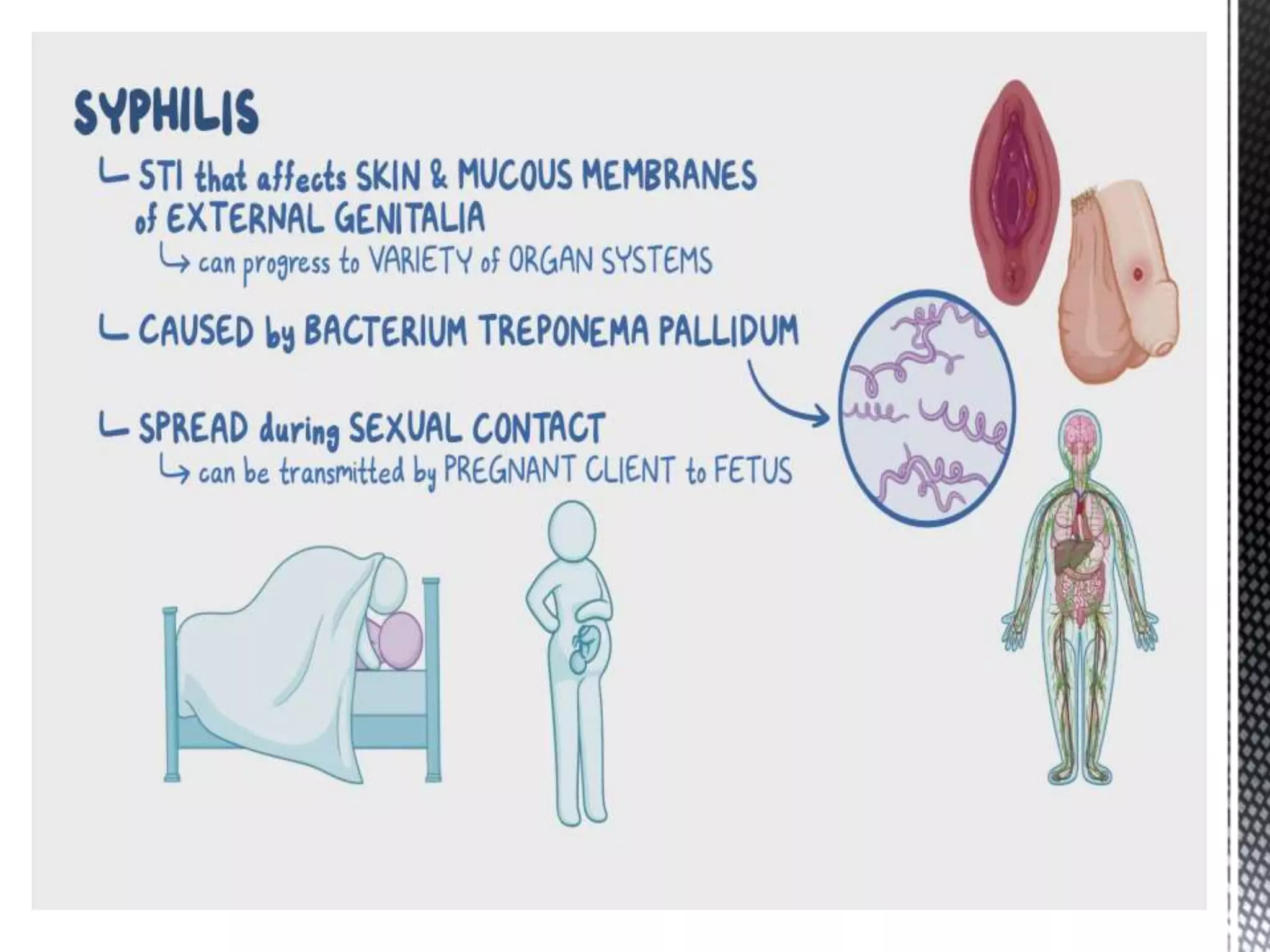 HIV-at-SYPHILIS-Autosaved.ppt