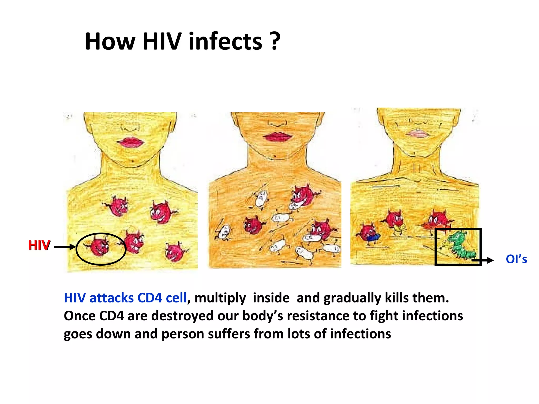 Hiv 101 dr susan gregorio | PPT