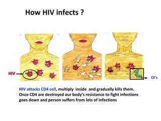 Hiv 101 dr susan gregorio | PPT