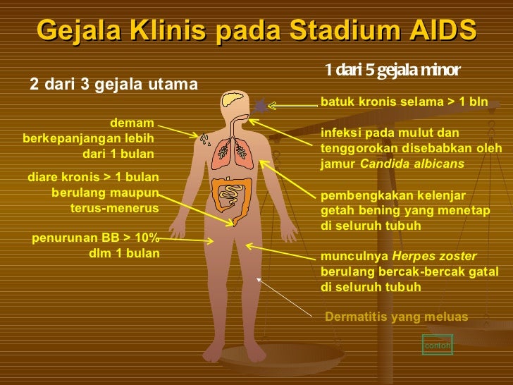 Ciri Ciri Sakit Hiv - Homecare24