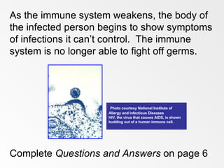 Hiv.Aids 6th Grade | PPT