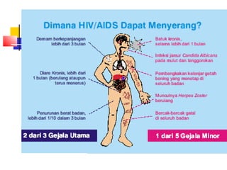 Hiv a ids dr. arif bsok | PPT