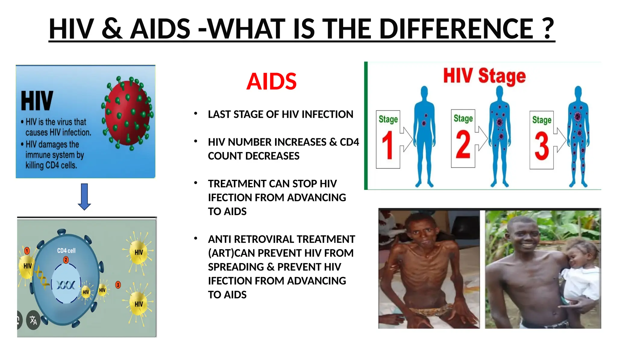 HIV AND AIDS -PREVENTION, TREATMENT WAY FWD | PPTX