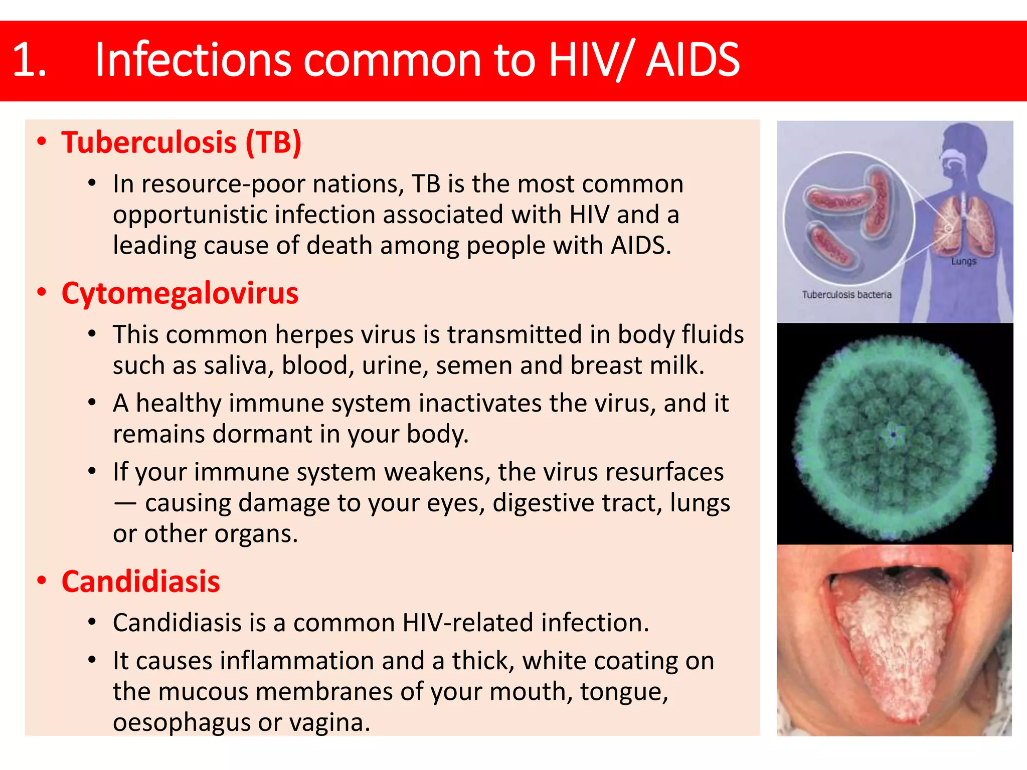HIV AIDS - Risk factor, Clinical feature & Complication | PPTX
