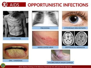 HIV AIDS STI Awareness among Adolescent.pptx