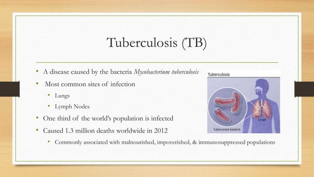 Hiv aids & tuberculosis in south africa | PPTX | Infectious Diseases ...