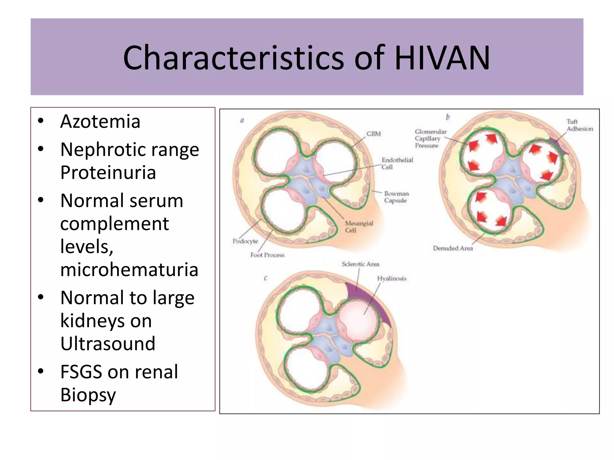 Hivan | PPTX
