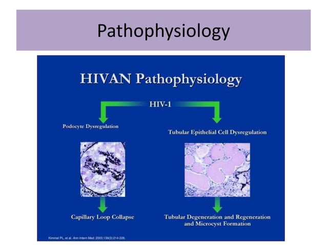Hivan | PPT