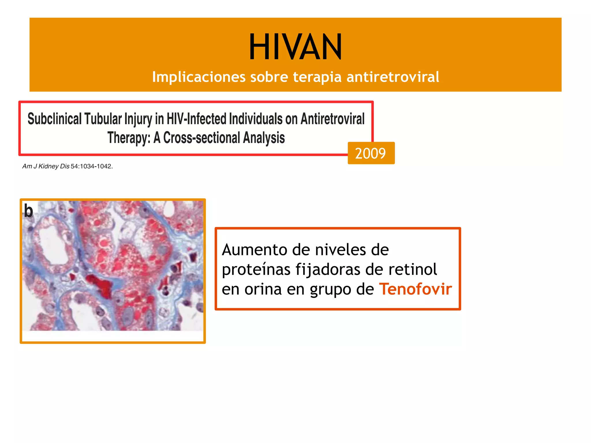HIVAN (Nefropatía asociada al VIH) Evidencia al 2015 | PPTX ...