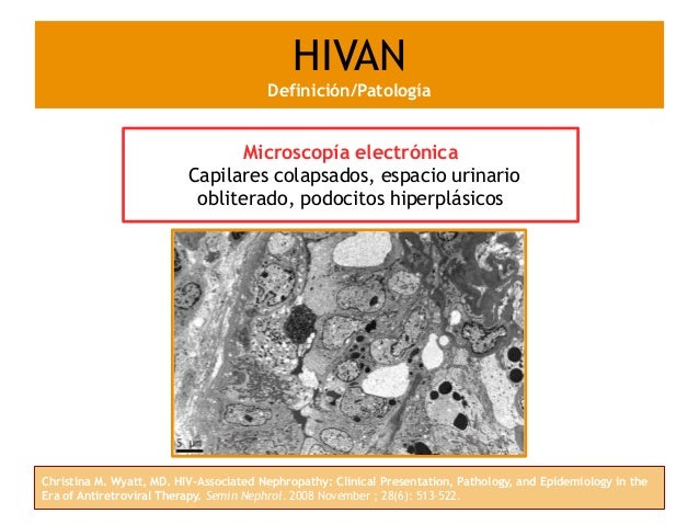 HIVAN (Nefropatía asociada al VIH) Evidencia al 2015