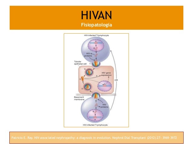 HIVAN (Nefropatía asociada al VIH) Evidencia al 2015