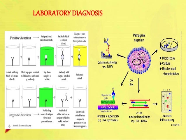 Hiv and opportunistic infections Hiv and opportunistic infections