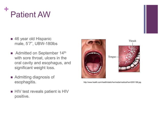 Hiv Case Study Presentation | PPTX | Infectious Diseases | Diseases and ...