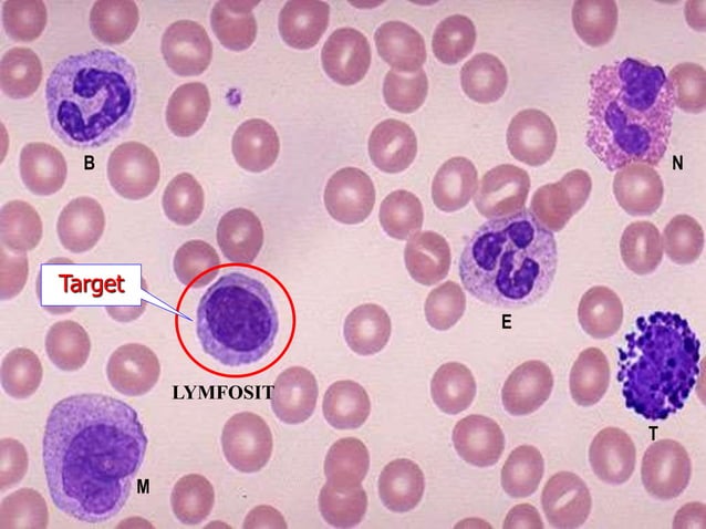 Hiv dan aids review zul | PPTX