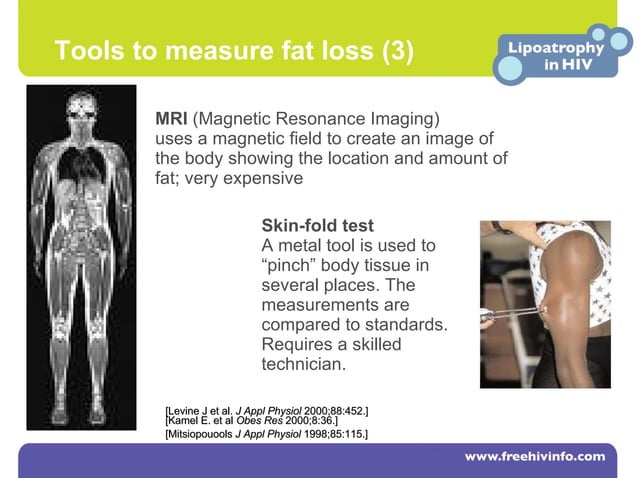 HIV Lipoatrophy 2007 | PPT