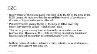 Ocular manifestations of HIV | PPTX