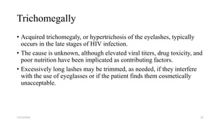 Ocular manifestations of HIV | PPTX