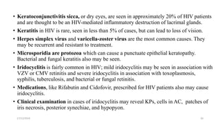 Ocular manifestations of HIV | PPTX