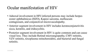 Ocular manifestations of HIV | PPTX