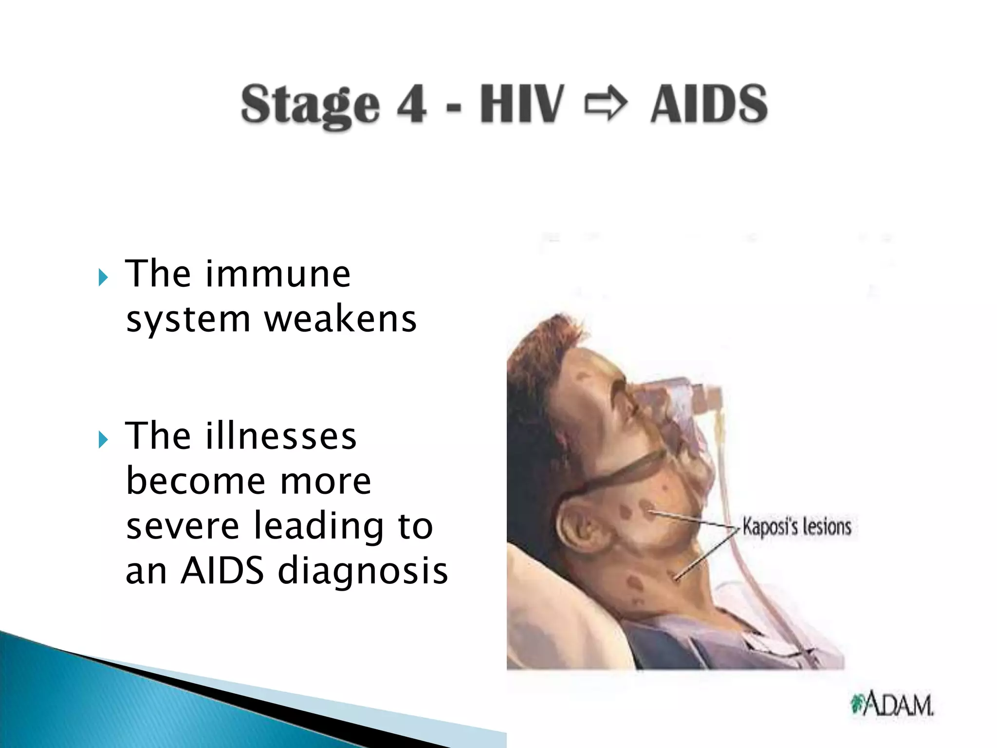 HIV Virus (Info., causes, Treatment) | PPTX