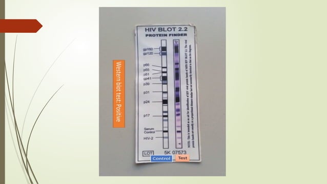 human immunodeficiency virus [HIV] PDF SQ | PPT