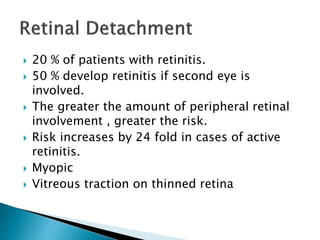 Hiv retinopathy | PPTX