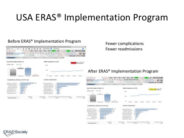 The role of the ERAS society
